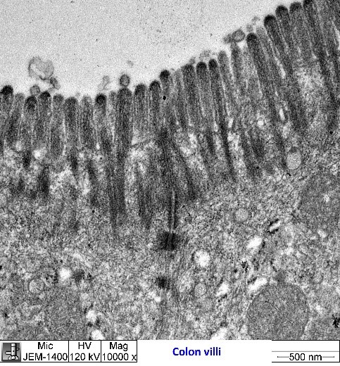 Advanced Centre for Treatment Research & Education in Cancer | Electron ...